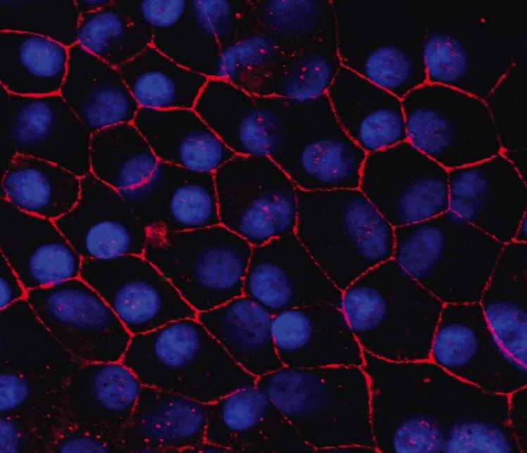 New Stem Cell Model Replicates Macular Degeneration - Research to ... New Stem Cell Model Replicates Macular Degeneration - Research to ...